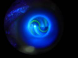 Preguntas y respuestas sobre el glaucoma | Blogs Quirónsalud